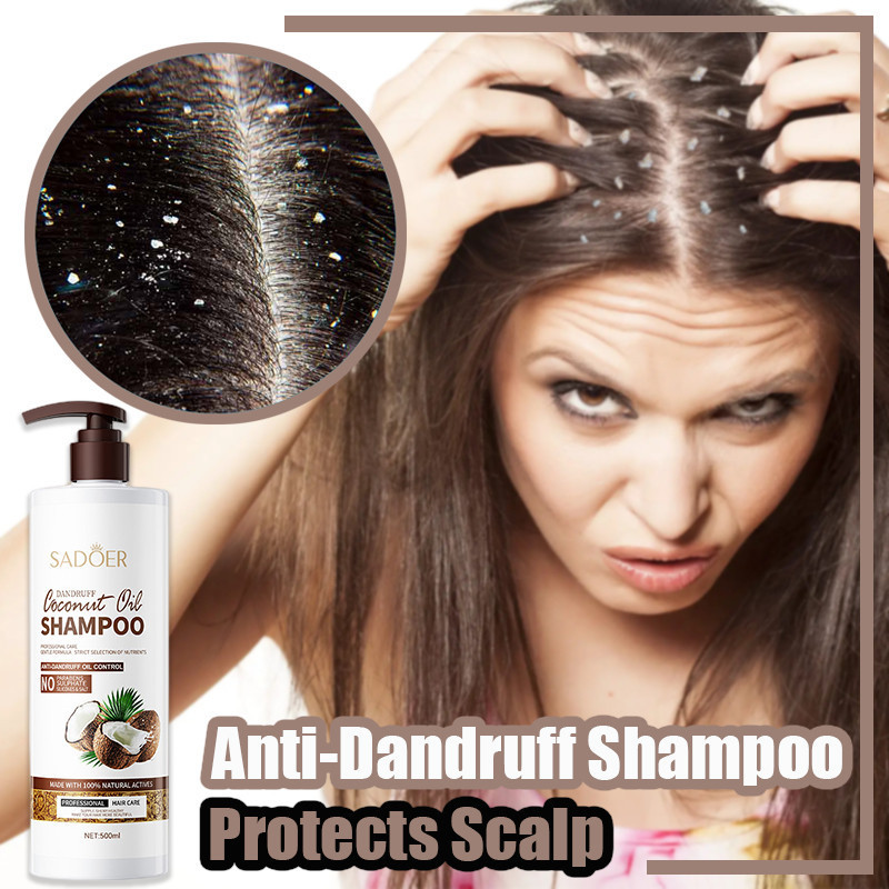 Original Coconut Oil Dandruff Shampoo Kelemumur Ubat Kelemumur Kepala Psoriasis Shampoo Itchy ...