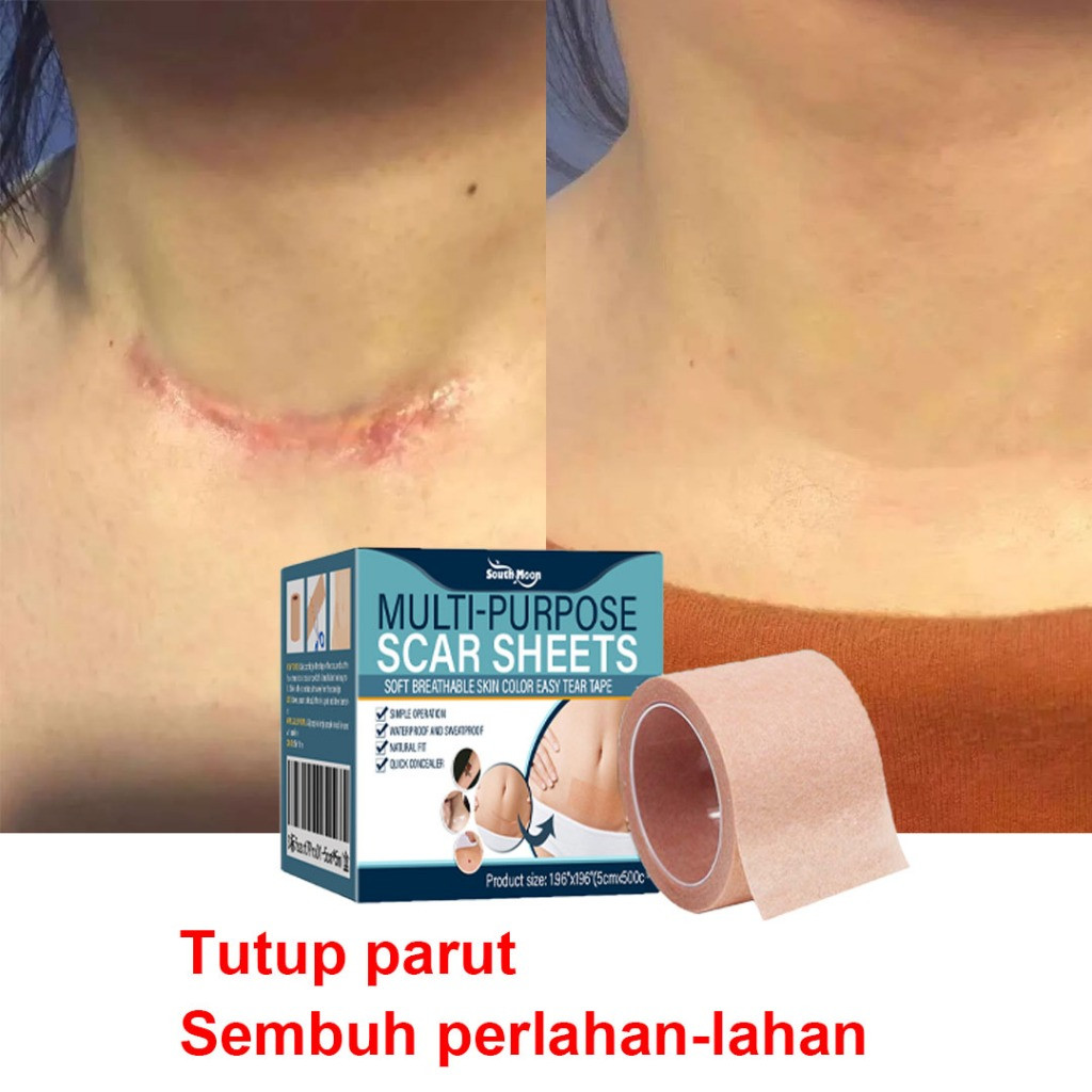 Silicone Scar Sheets Scar Patch Surgery Scar Removal Skin Repair ...