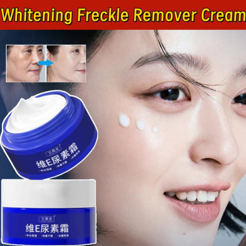 Whitening/Freckle Removal[Old Spots and Yellow Spots Disappear]Spot Fading Urea Cream Deep ...