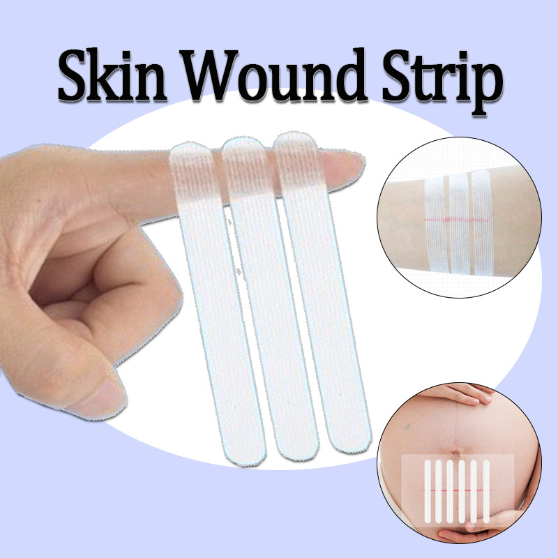 6/10PCS Medical Surgical Tape Sterile Wound Suture Dressing Postpartum ...