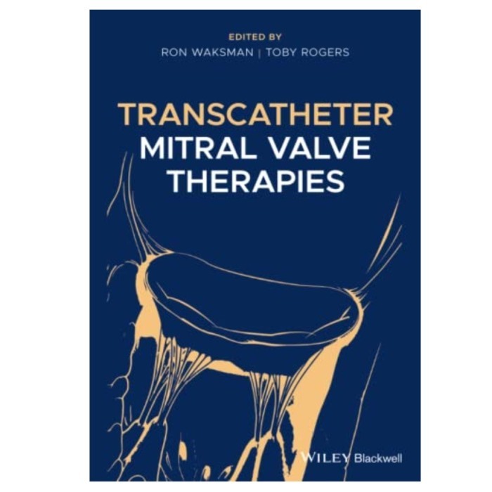 Mitral Valve Therapy Transcateter Book | Shopee Malaysia