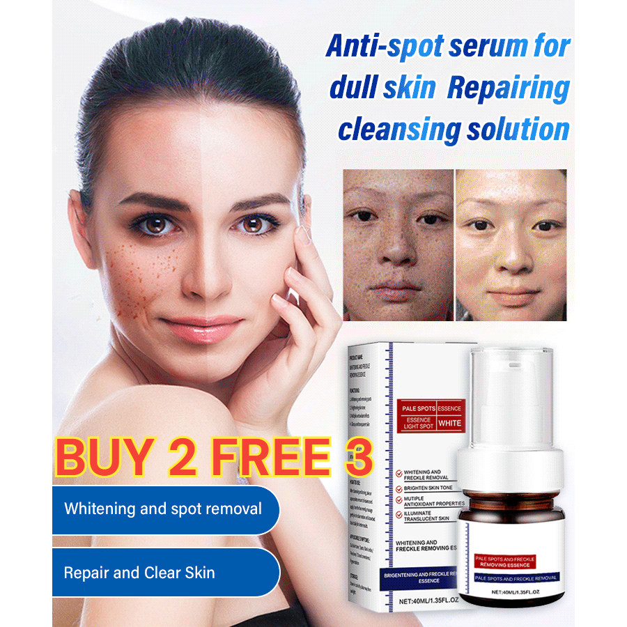 💥Effective in 7 Days💥Freckle-Banishing Serum for Face Repair and ...