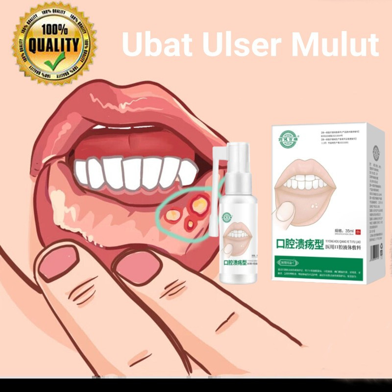 Ubat Ulser Mulut Oral Ulcer Mouth Ulcer Spray Canker Sore Treatment ...