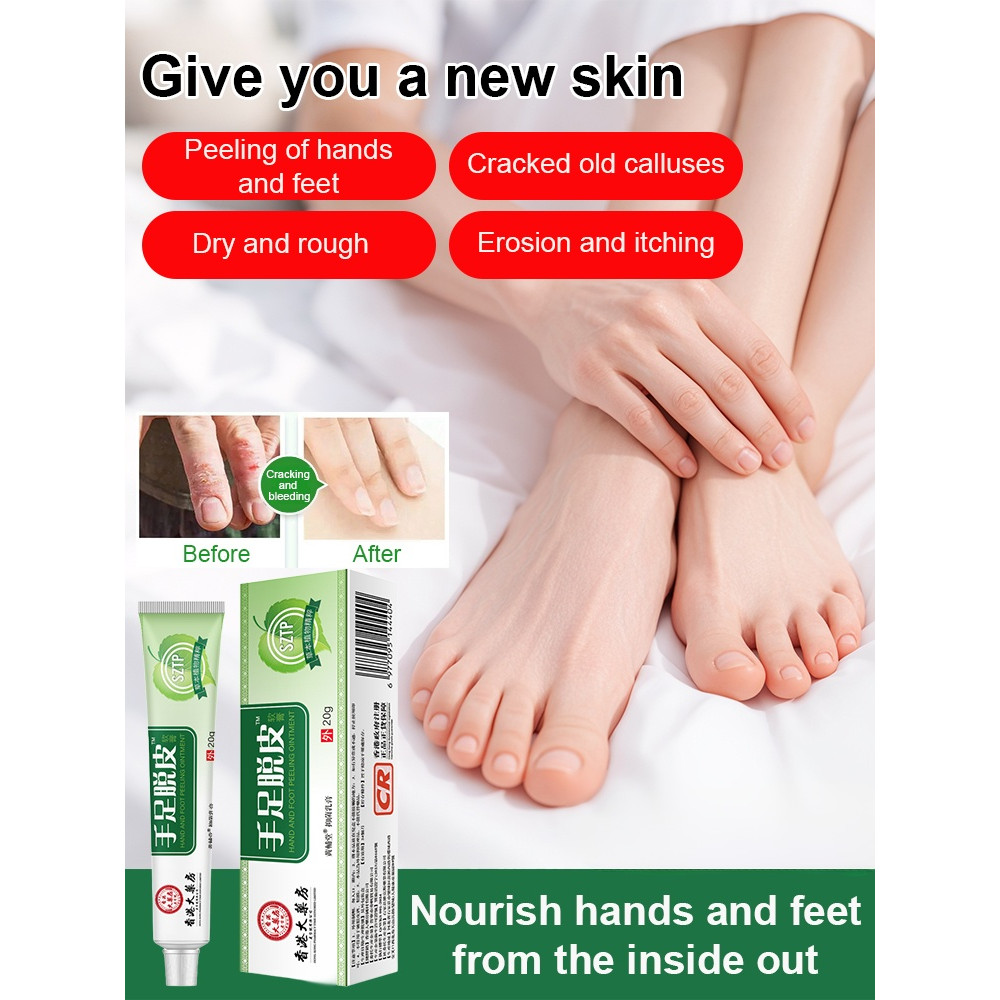 Hong Kong Pharmacy Skin Foot Itch Relief Cream | Shopee Malaysia