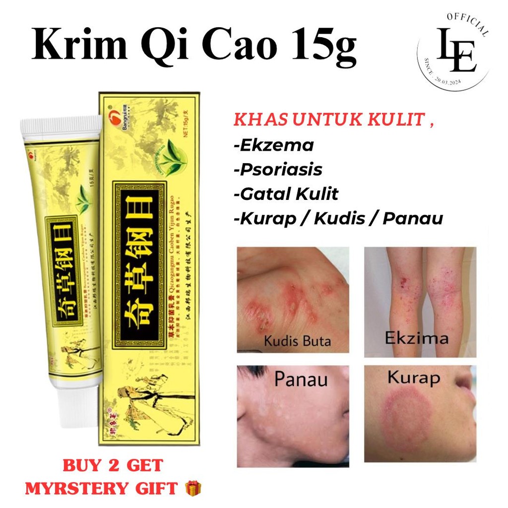 Ekzema Psoriasis Kurap Gatal Kulit Ubat Krim Herba Cina 15g / Eczema ...