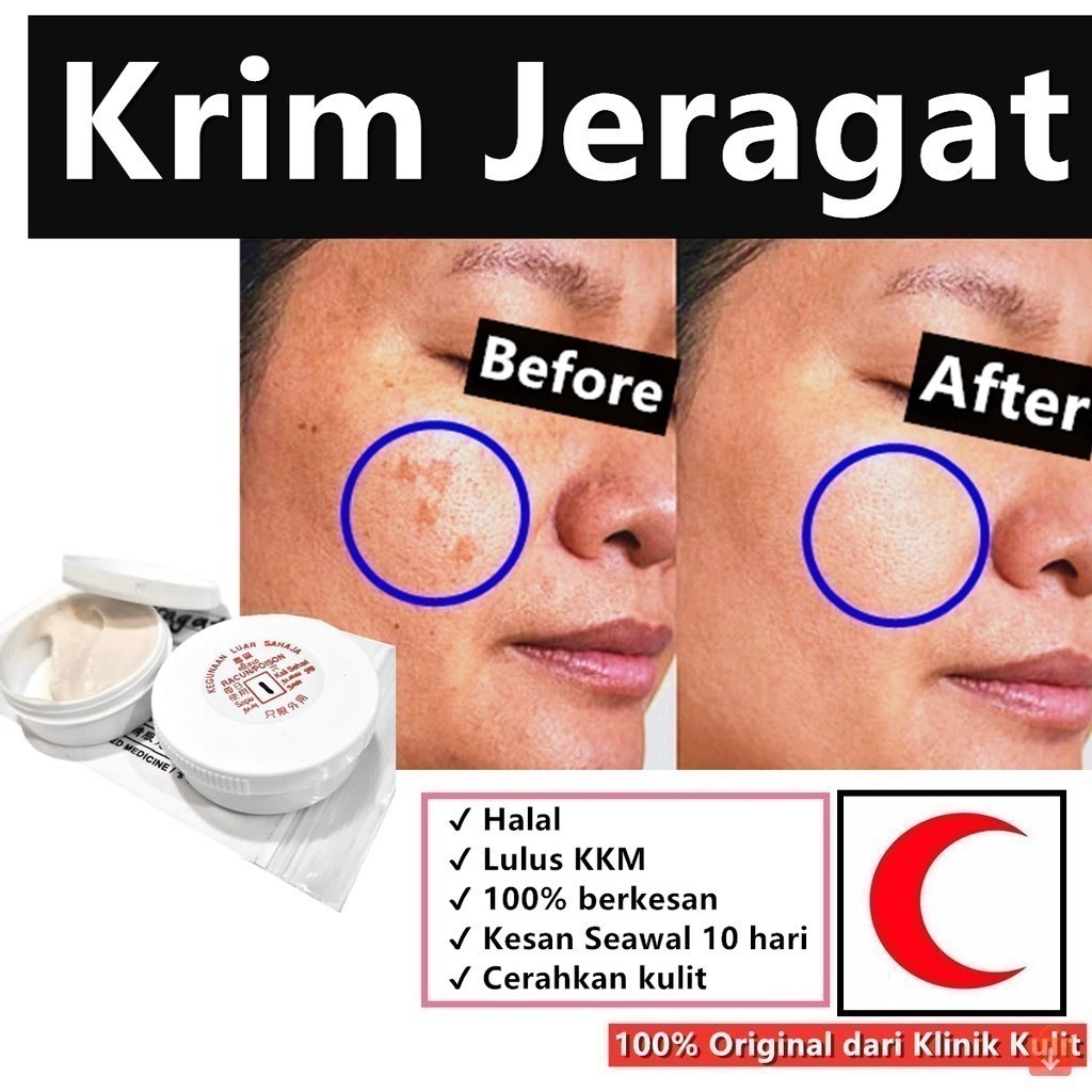SALE!! Krim Jeragat Pigmentation Cream dari Klinik Putih Jeragat Skin ...