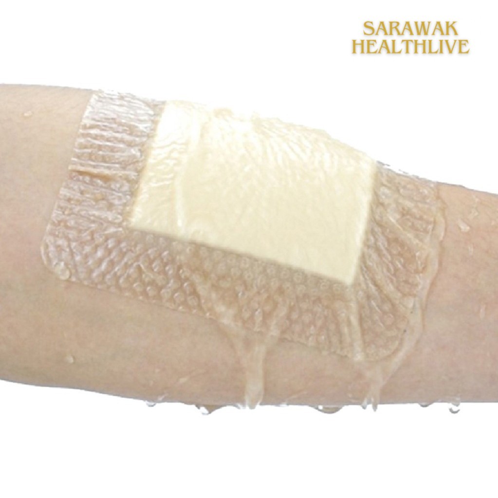Wound Patch Hydrocolloid Adhesive Dressing Wound Dressing Sterile ...