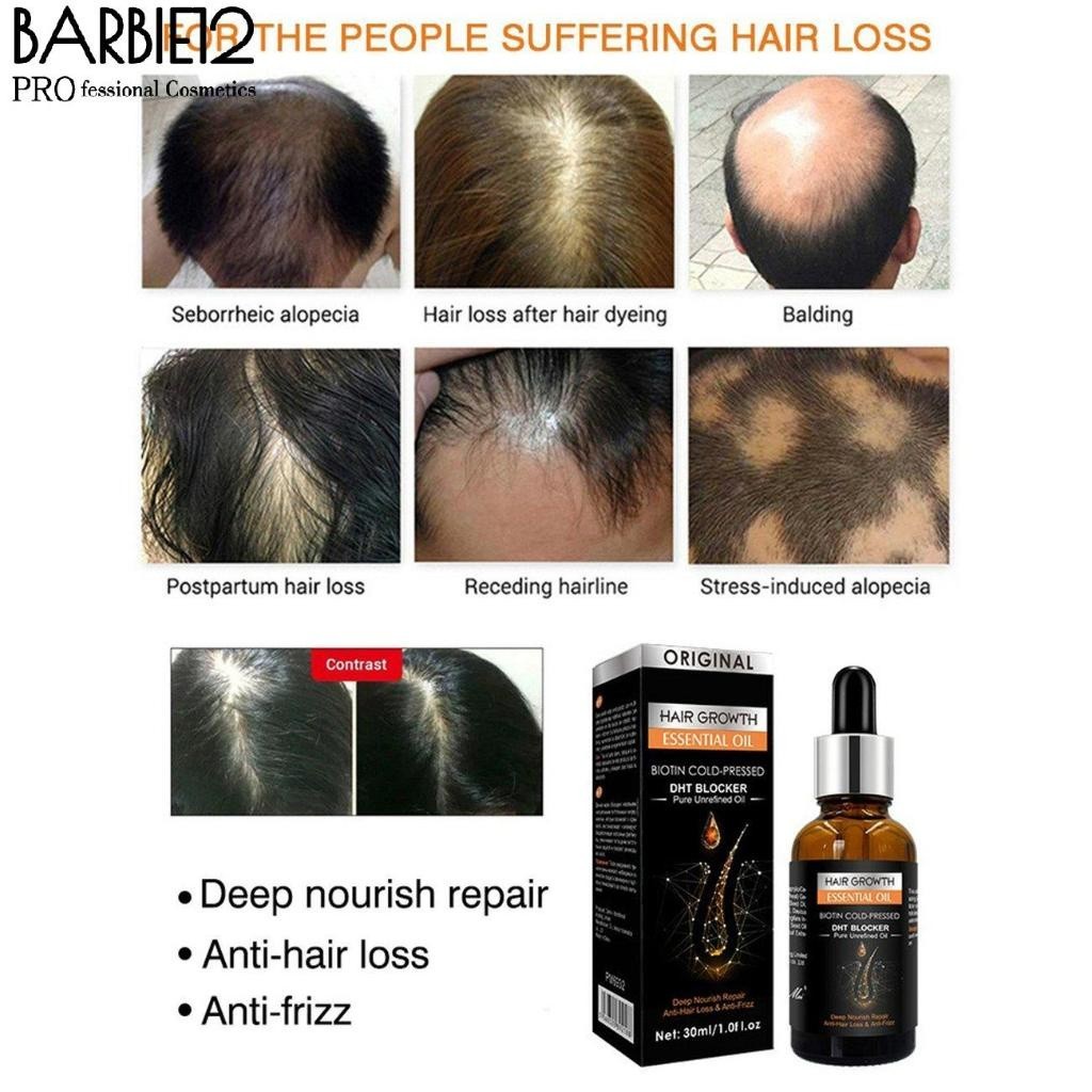 Hair Growth Essential Oil Biotin Cold-Pressed DHT Blocker and Hair ...