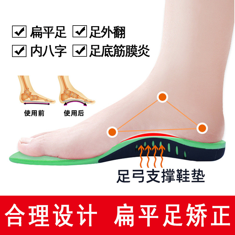 Flat Foot Valgus Inner Eight Character Correction Leg Shape Arch Pad ...