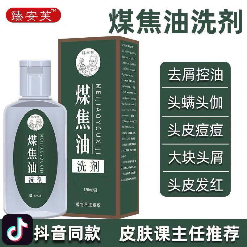 Coal tar medical shampoo large dandruff seborrhea care derma Kerosene ...