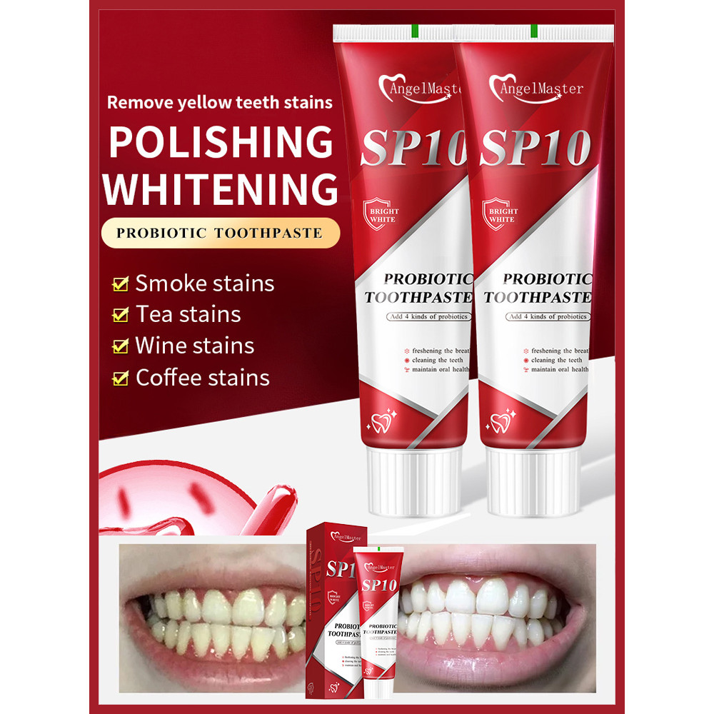 🌹100% GENUINE🎀7-Day Fast Whitening Teeth益生菌速效亮白牙膏[Better Than Teeth ...