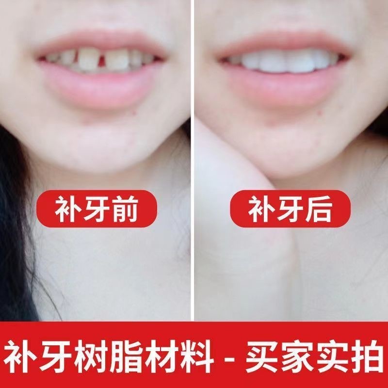 Temporary denture resin self-filling teeth missing teeth incisor ...