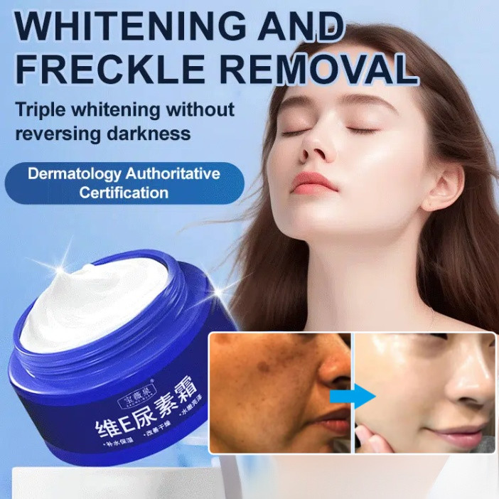 7 Days【Old Spots and Yellow Spots Disappear】Spot Fading Urea Cream Triple Whitening/Freckle ...