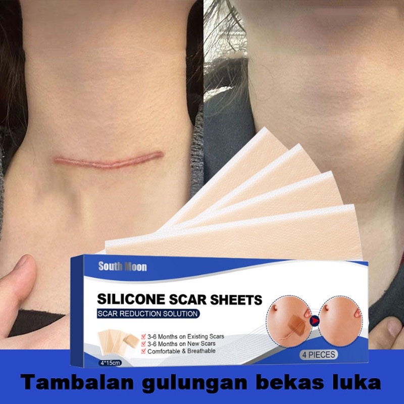 Silicone Scar Sheet Gel 4PCS 4cm x 7.5cm keloid Scar removal Silicone ...