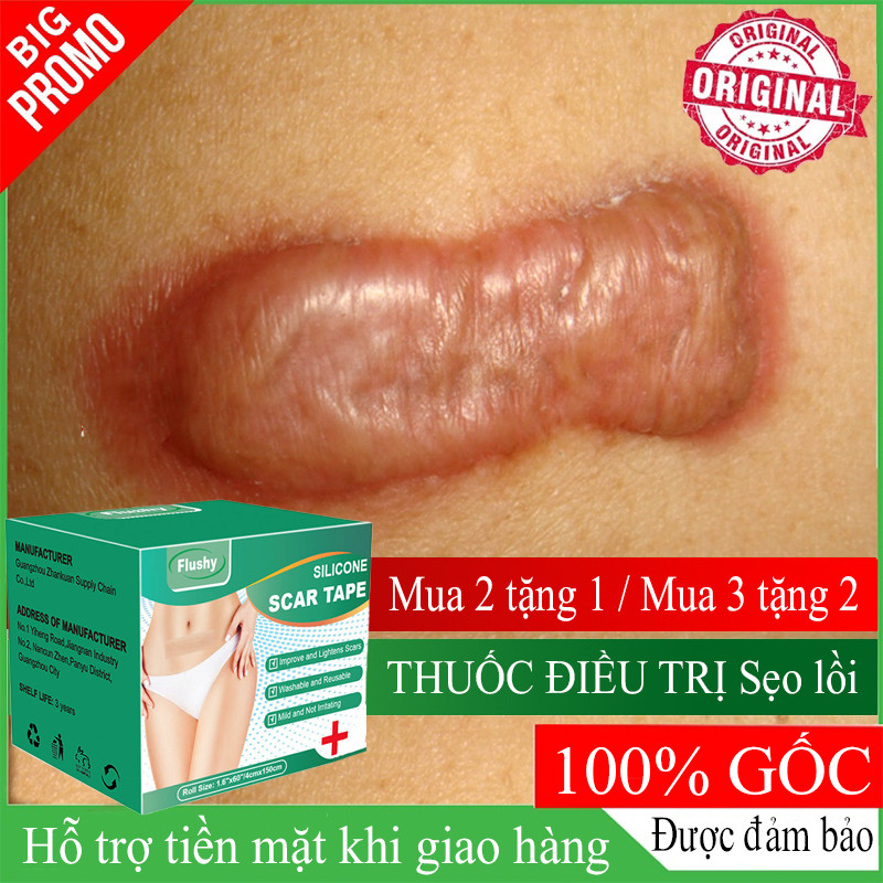 Scar Cover Patch, Scar Blurring Patch, Keloid Scar Treatment, Dark Scar Removal Patch, Keloid ...