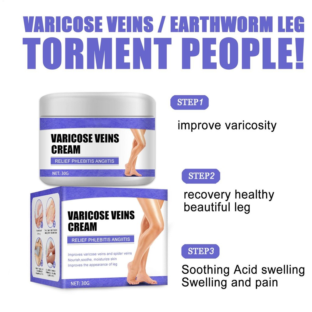 Varicose Vein Treatment Cream 30g Spider Vein Pain Varicosity Effective ...