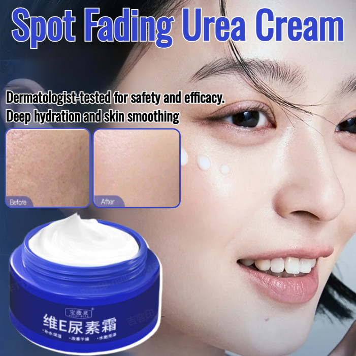 【Old Spots and Yellow Spots Disappear】Spot Fading Urea Cream/ Removing Melasma Freckle Removing ...