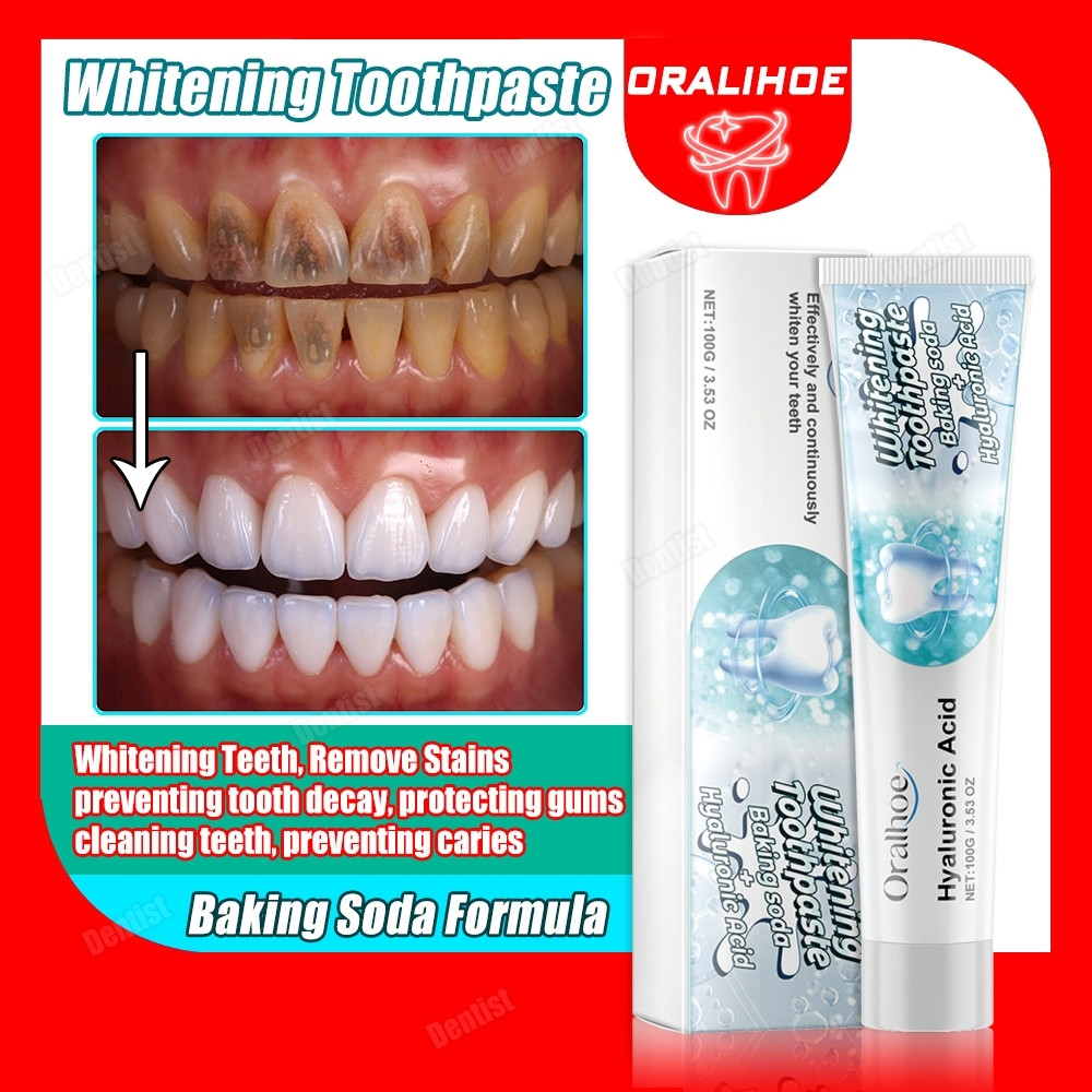 Teeth Whitening Toothpaste Mint Baking Soda Toothpaste Japanese ...