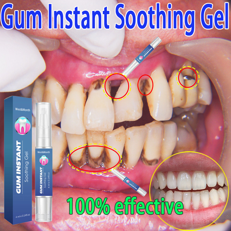 Gum Instant Untuk Gigi Gum Care Gel Penguat Gigi Penguat Gigi Tambal ...