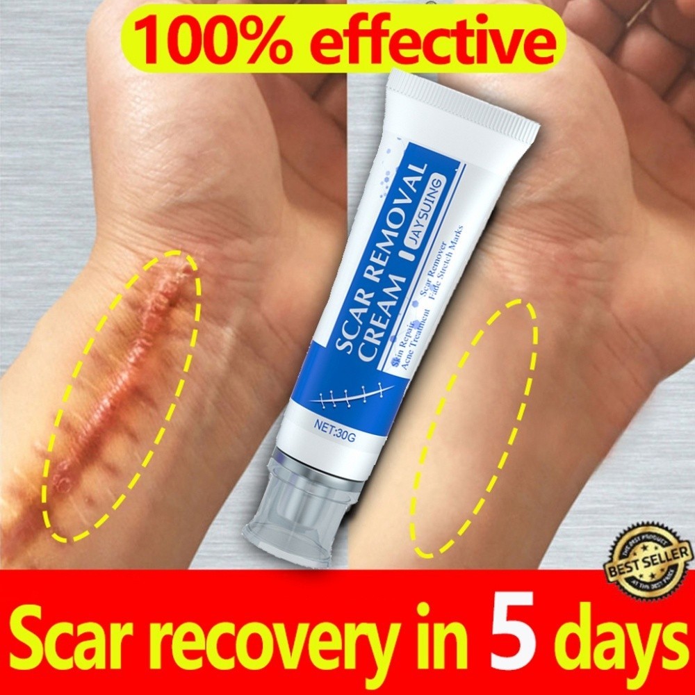 Gel removes old leg scars, original brand acne cream, fades new burns ...