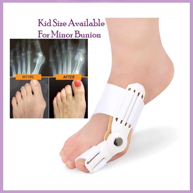 Big Toe Bunion Corrector For Bunion Toe Seperator Splint Hallux Valgus ...
