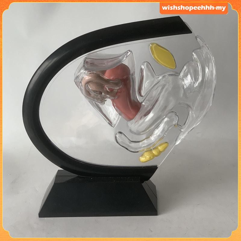 [WishshopeehhhMY] Female Reproductive System Model Reproductive Uterus ...
