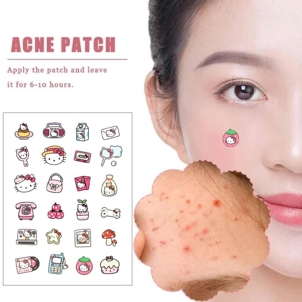 Cartoon Cat Acne Sticker Cute Mild And Non-irritating Acne Sticker Care ...