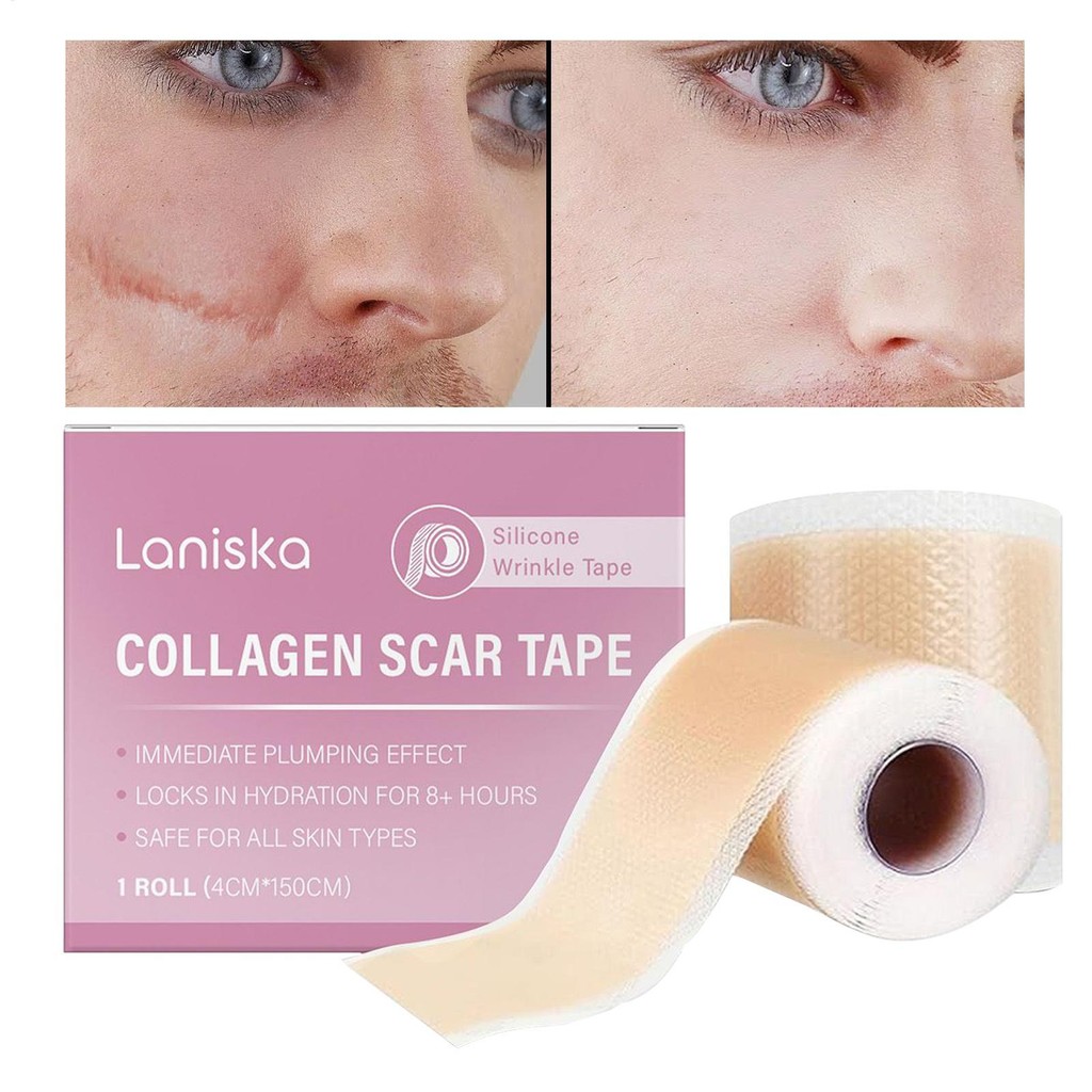 Scar Tape Keloid Removal Strip 1.6x59 Inch Silicone Scar Removal Strips ...