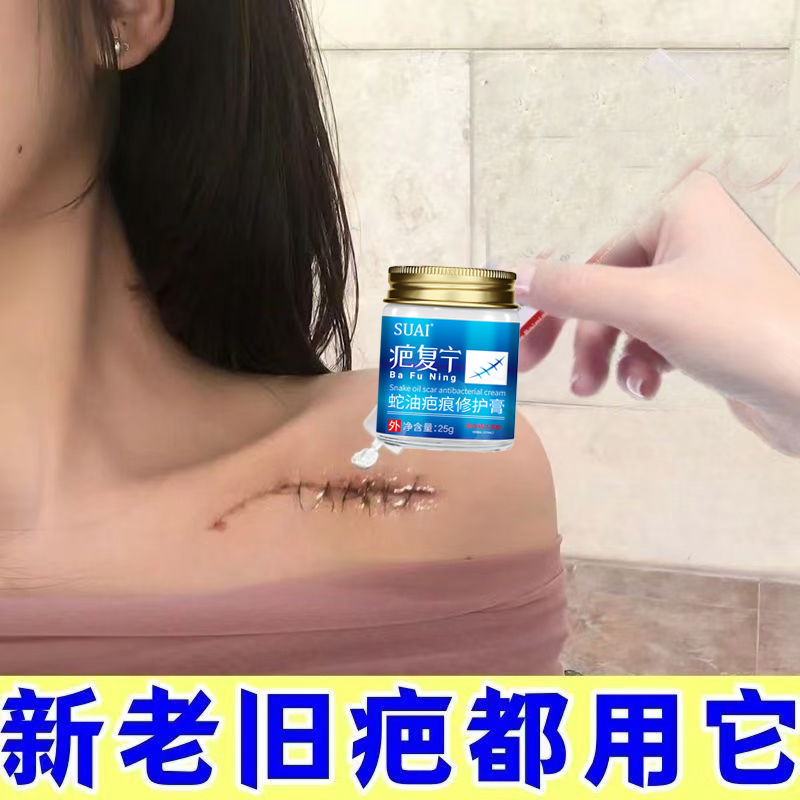 Scar removal cream hyperplasia repair scar-free scar removal cream ...
