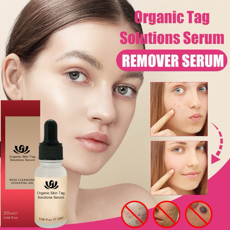 Wart Removal No trace black mole repair liquid remove black mole repair ...