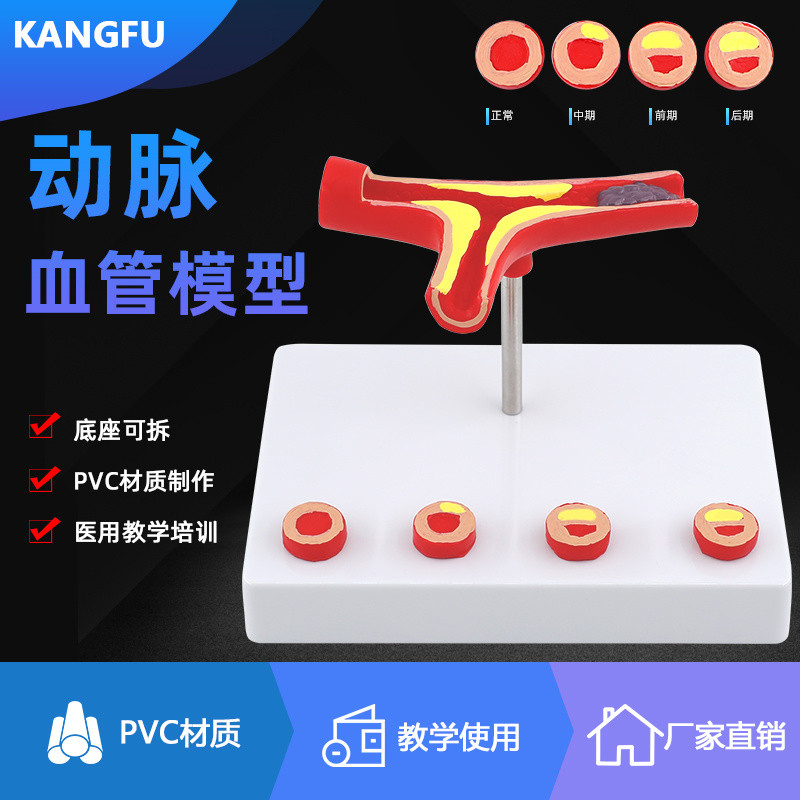 Human Body Branch Congee Sample 11 Hardened Cardiovascular Artery 1 ...