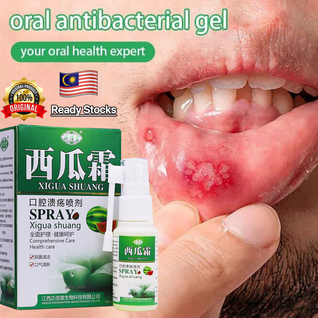 Oral ulcer spray mouth ulcers spray medicine spray mouth ulcers HFMD ...