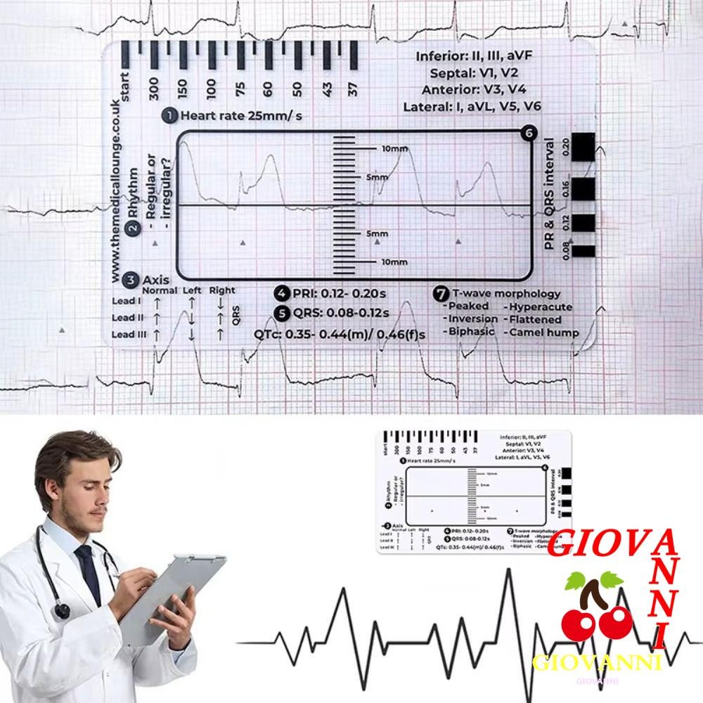 GIOVANNI Ecg/Ekg Reference Guide, Interpretation with Protective Sheath ...