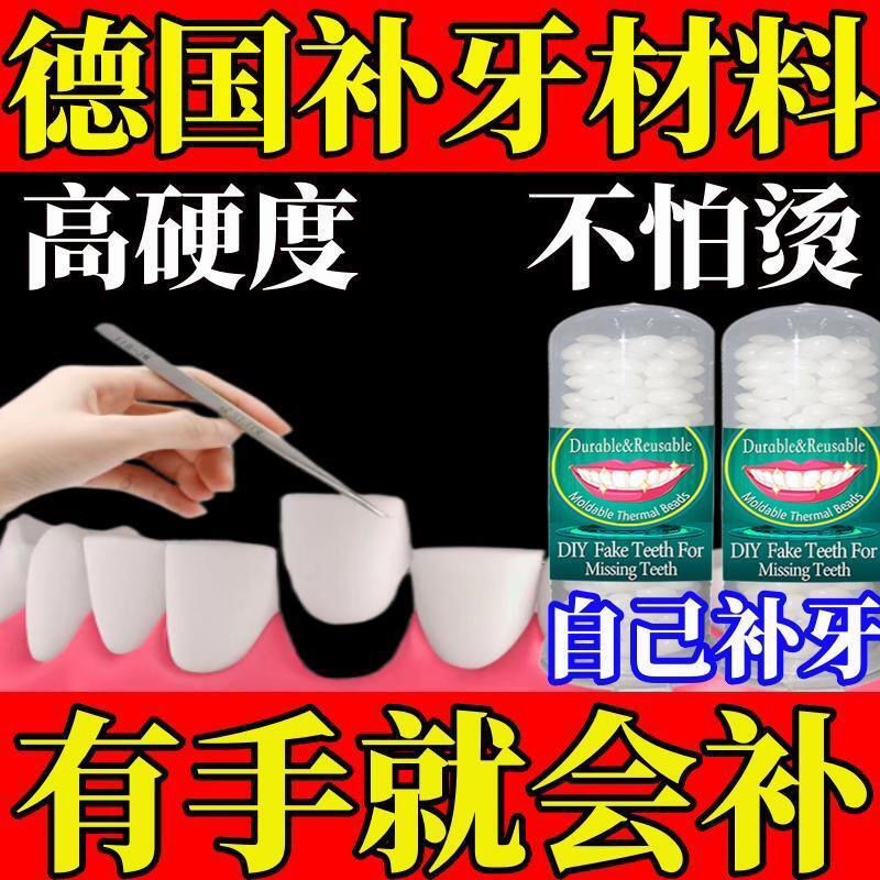 Own Filling Teeth Imported Nano Filling Teeth Material Resin Filling ...
