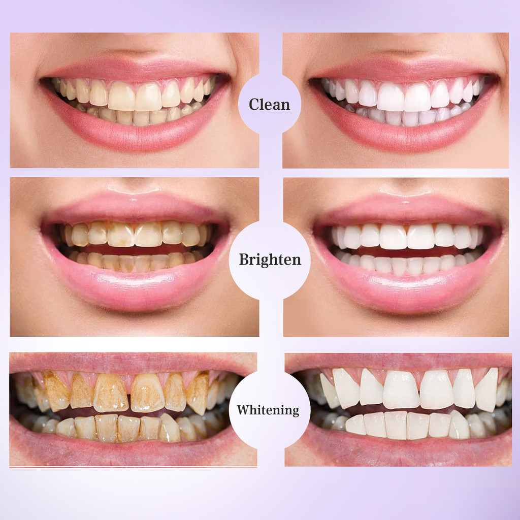 JKCK V34 Toothpaste for Whitening Teeth and Removing Stains | Shopee ...