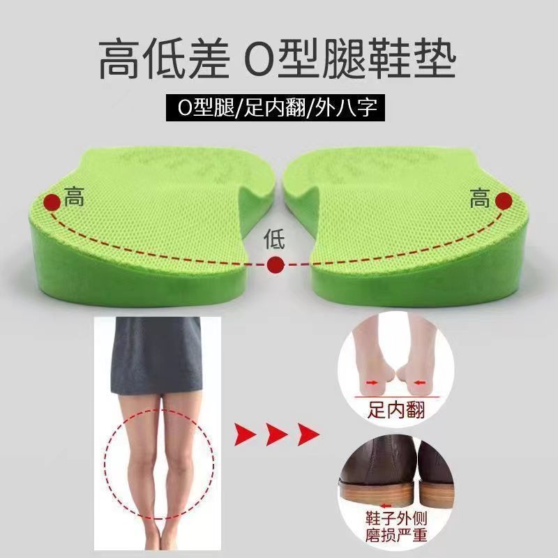 Foot Valgus Outer Eight Character xo Type o-Shaped Leg Correction Leg ...