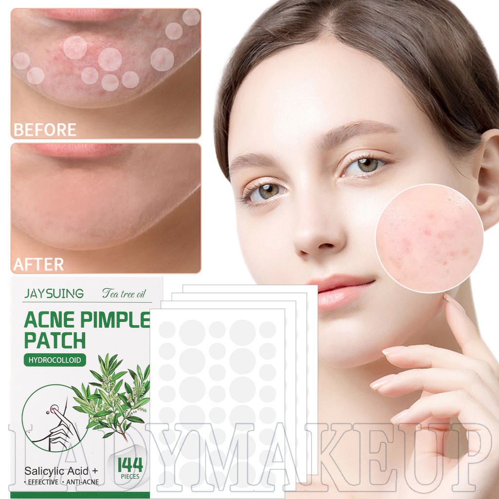 Transparent Invisible Soluble Acne Sticker-Creative Love Star Acne ...