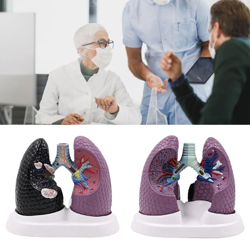 Top Pathological Lung Anatomy Model Human Anatomical Lung Model ...