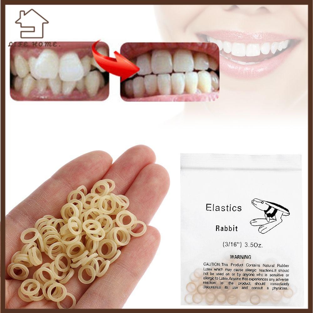YELGIRL Rubber Latex Rings Teeth Correction Health Medical Grade Teeth ...