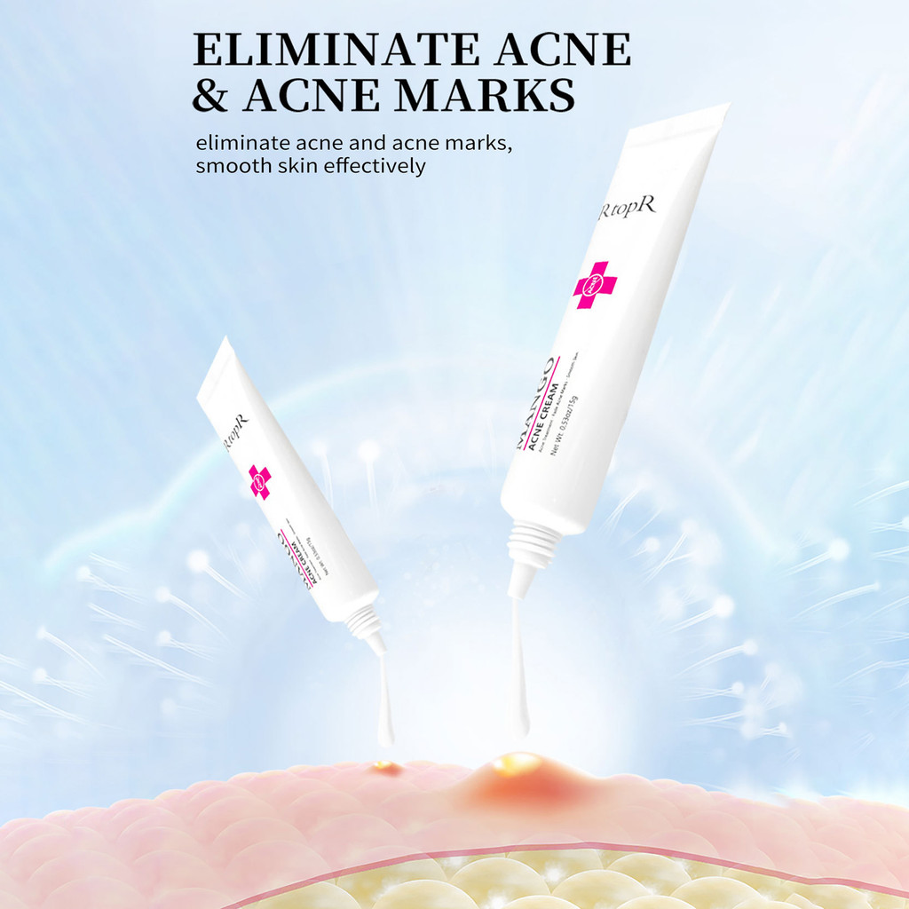 Mango Acne cream Facial Acne Acne Repair cream Net Content: 15g ...