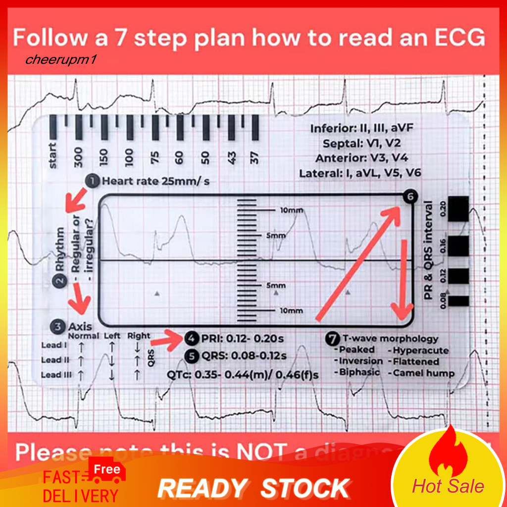 CHEER 7 Step Ruler Portable Ecg-interpretation Pocket Guide Transparent ...