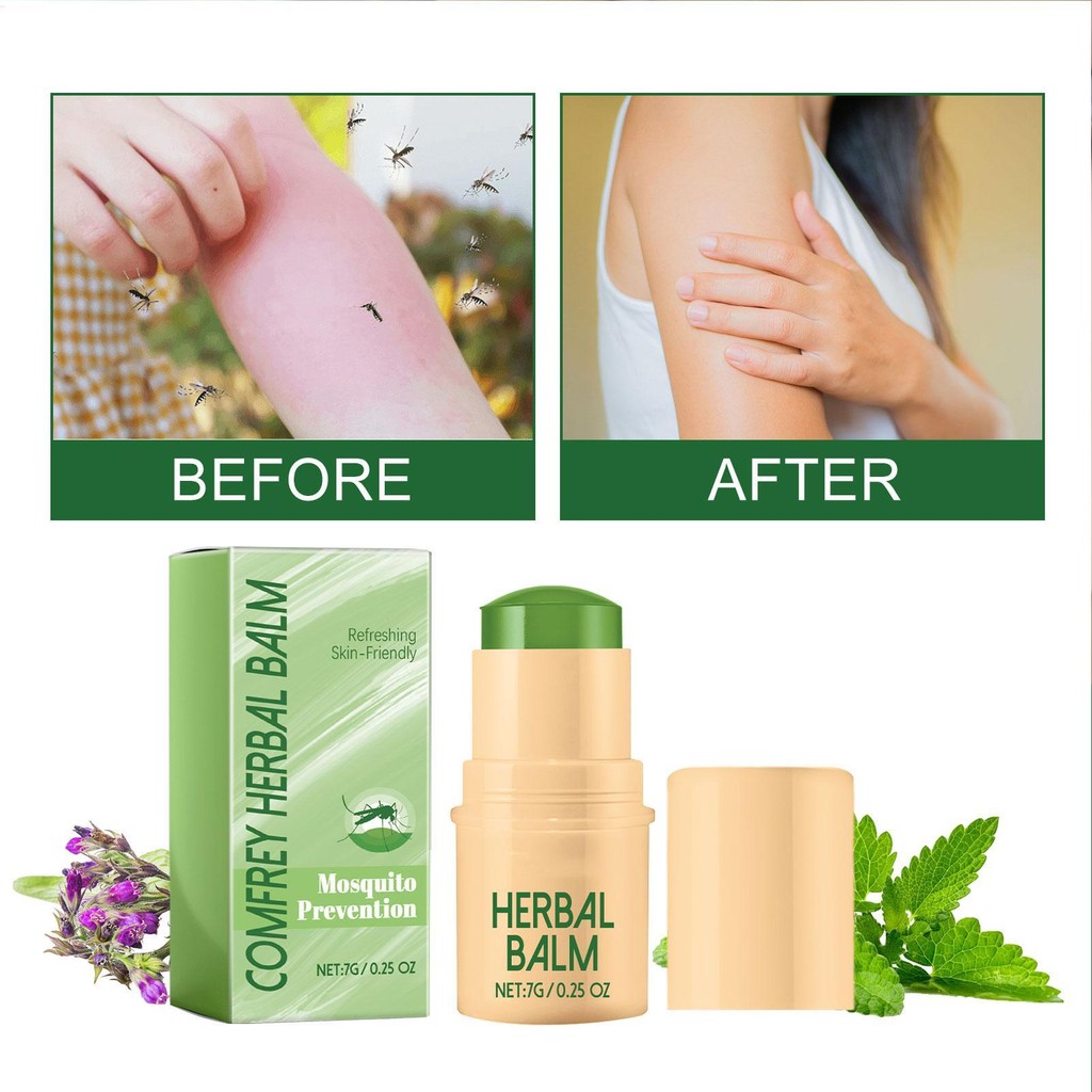 Skin Bite Cream Natural Soothing Cream Gentle Balm for Summer Bites ...