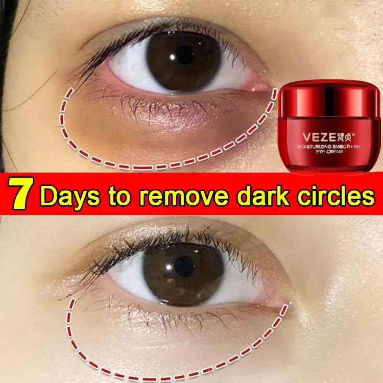 Remove Dark Circles Panda Eye Special Effects Eye Health Cream Dissolve ...