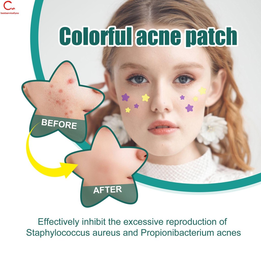 Fast Healing Acne Patch Extra Adhesion Acne Pimple Treatment Patches ...