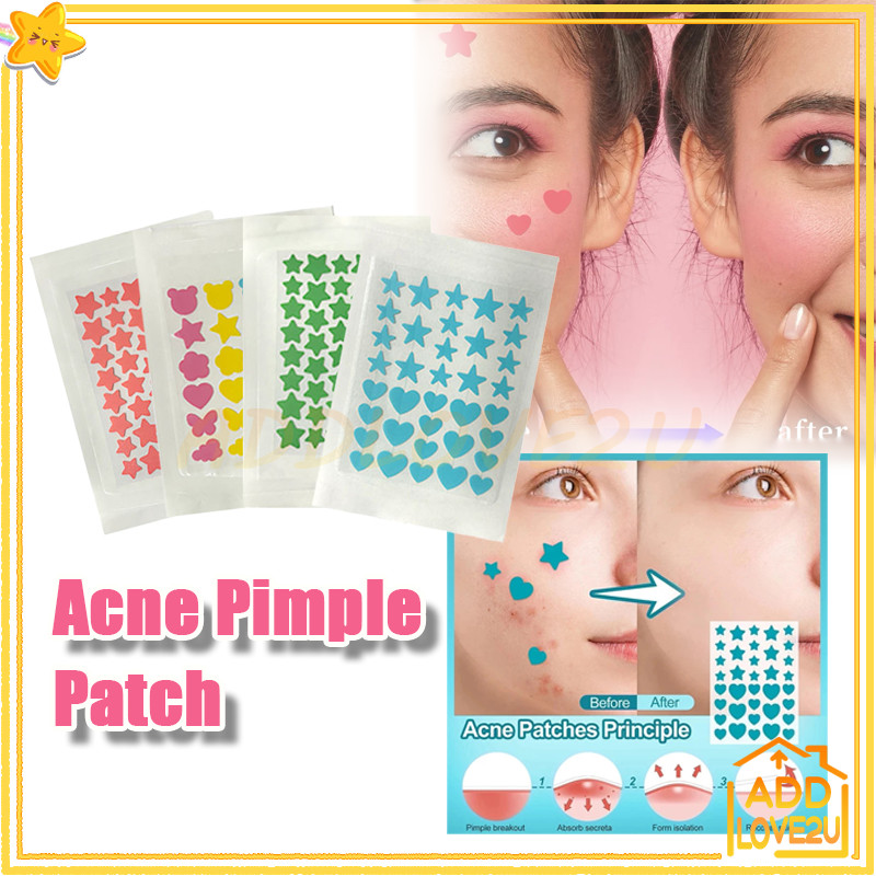 Acne Pimple Patch/cute Pimple Patch Acne Remover/Hydrocolloid Pimple ...