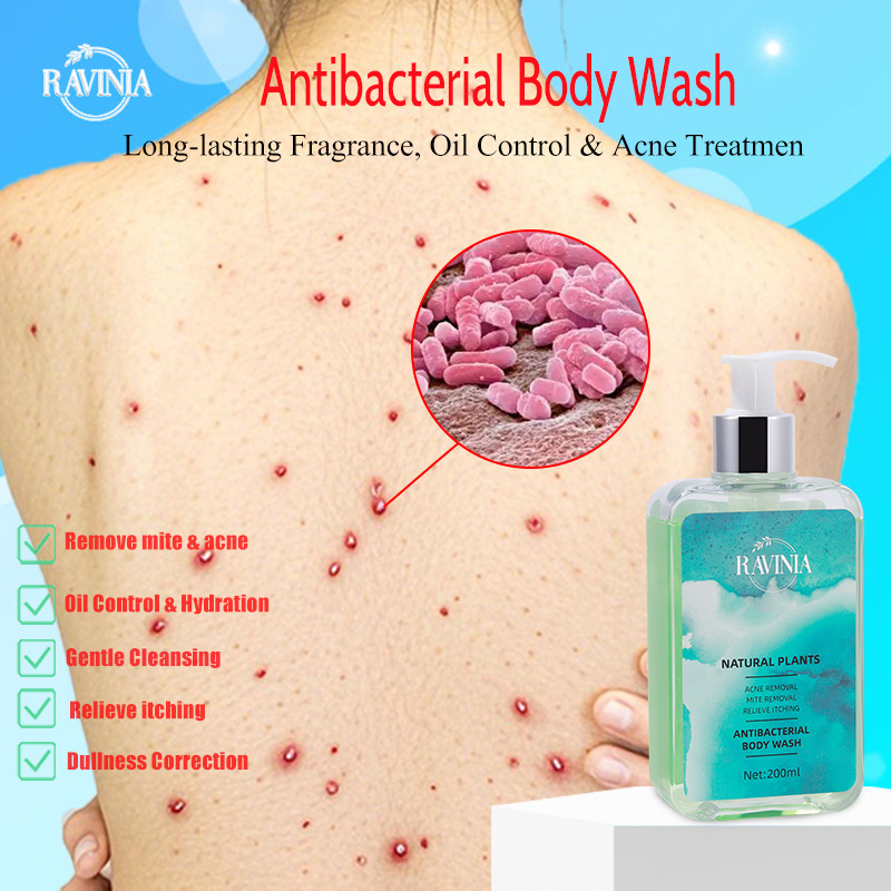 【RAVINIA】Acne body wash Eczema shower gel 200ml Plant essence mite ...