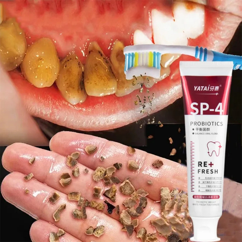 Teeth SP-4 whitening teeth whitening original probiotic toothpaste probiotics oral shark ...