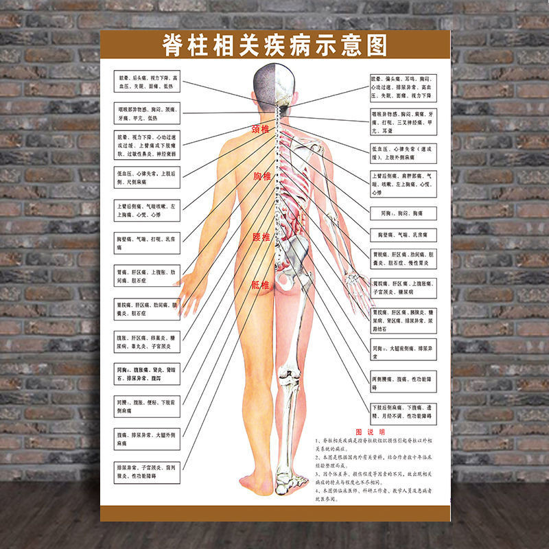 Spine Related Disease Human Body Meridian Chart Wall Chart Chinese ...