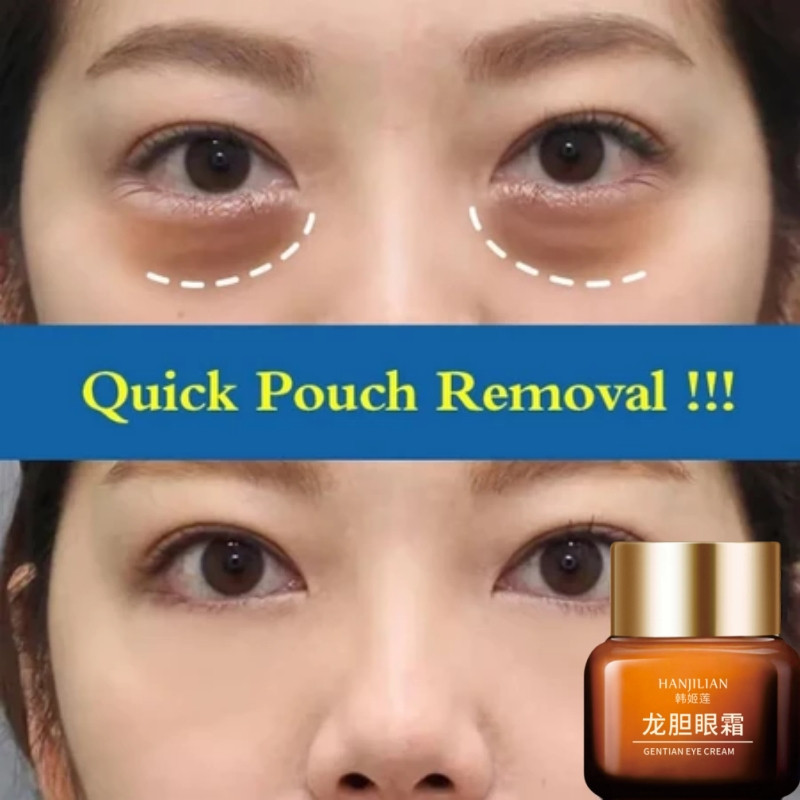 Precipitate Melanin Fade Dark Circles Heavy Fine Lines Brighten Skin ...