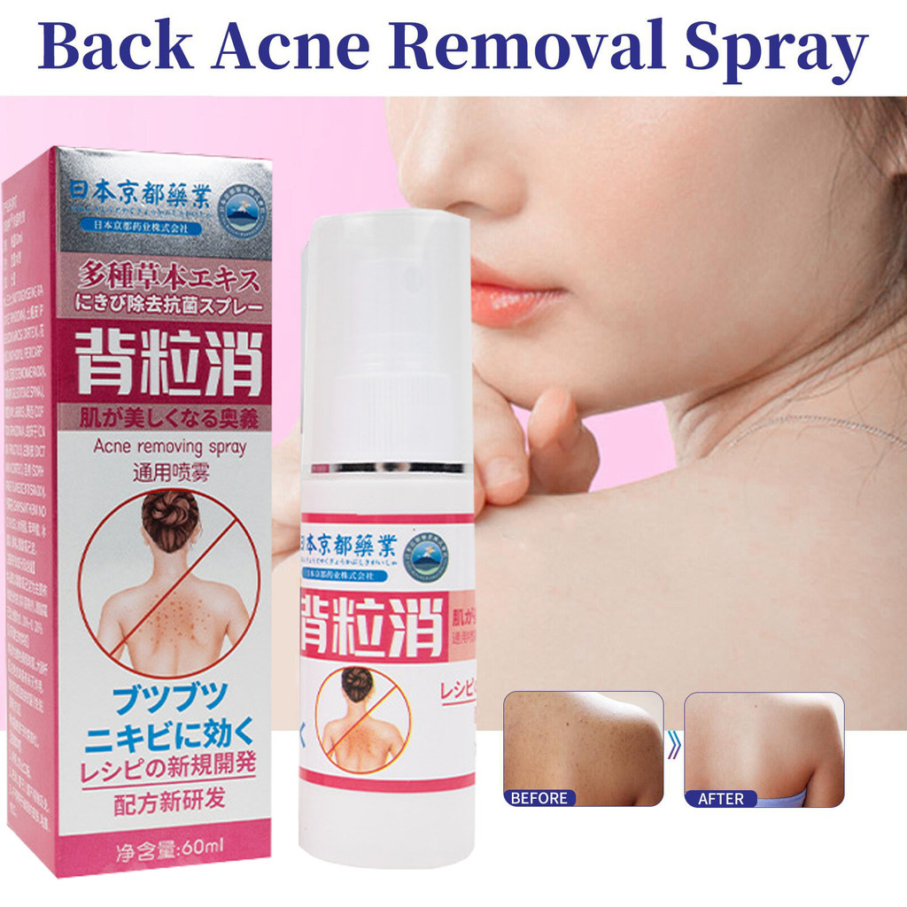 Back Particle Elimination Universal Spray Back Acne Pimple ...